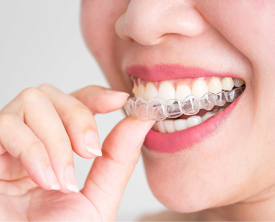 What Is Invisalign? A Comprehensive Guide to Clear Aligners - The ...