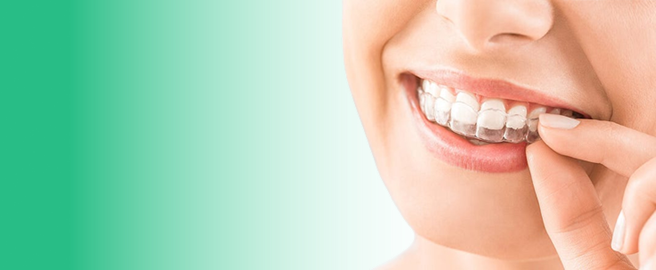 How Do Clear Teeth Aligners Straighten Your Teeth?