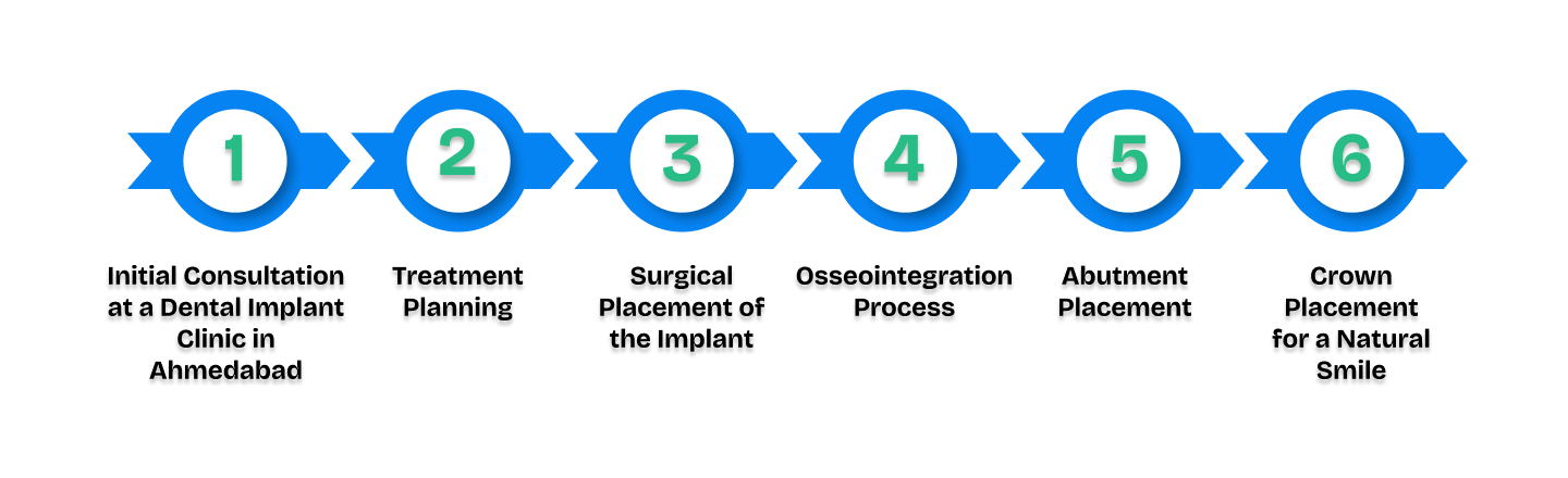 The Step-by-Step Process of Dental Implants in Ahmedabad